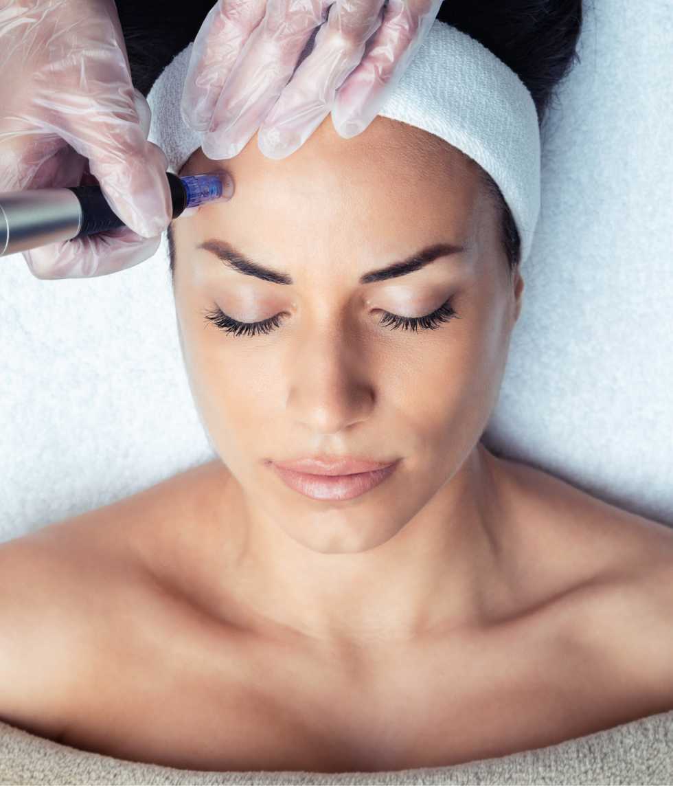 Skin Pen Micro-Needling | Escape Beauty Retreat